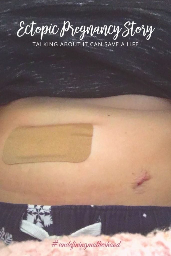 Coping with Miscarriage: Helpful Tips for Surviving the Grief