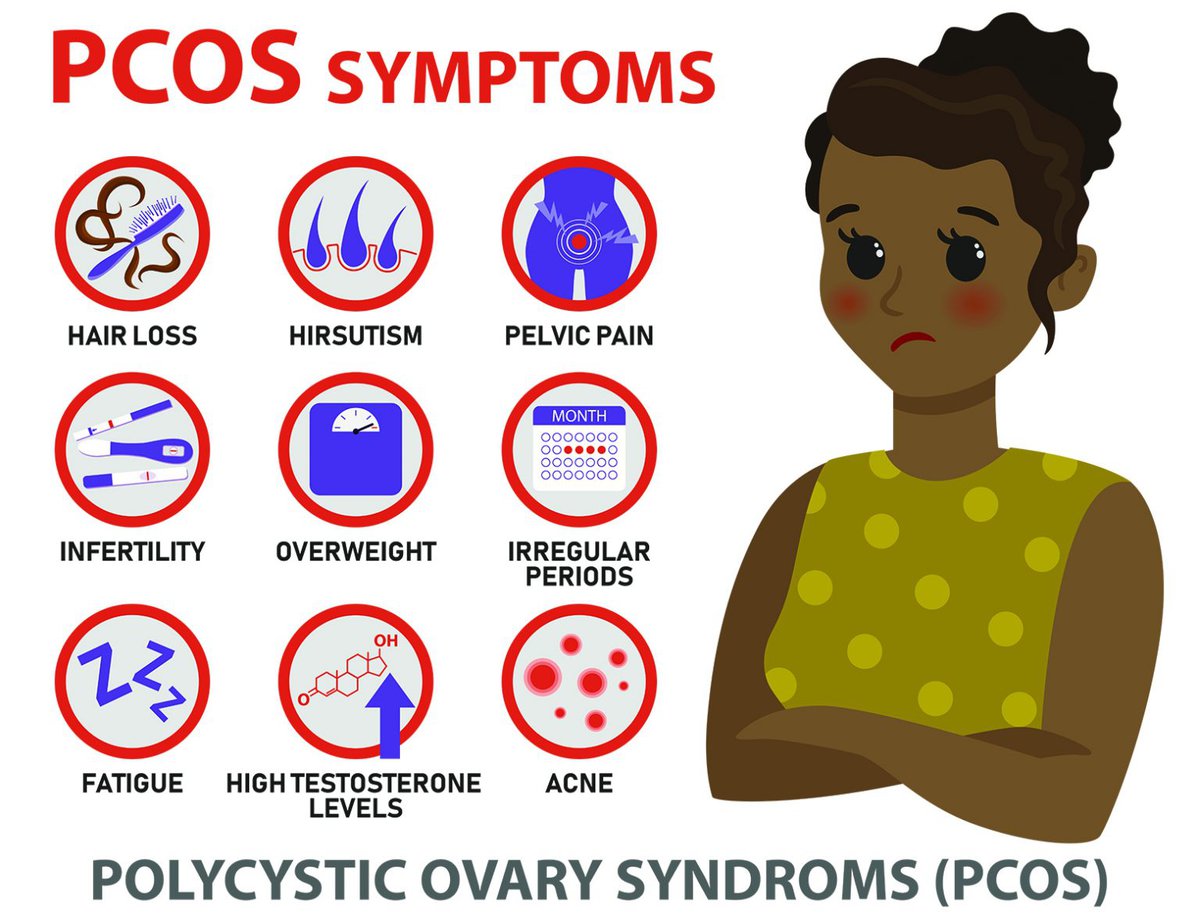 Everything You Need to Know About PCOS and Infertility
